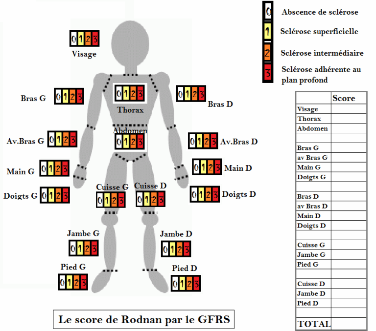 Le score de Rodnan – GFRS